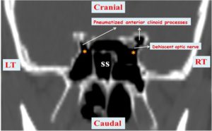 AJNS – African Journal of Neurological Sciences | » EVALUATION OF THE ...