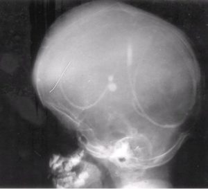 AJNS – African Journal of Neurological Sciences | » COMPLETE ...